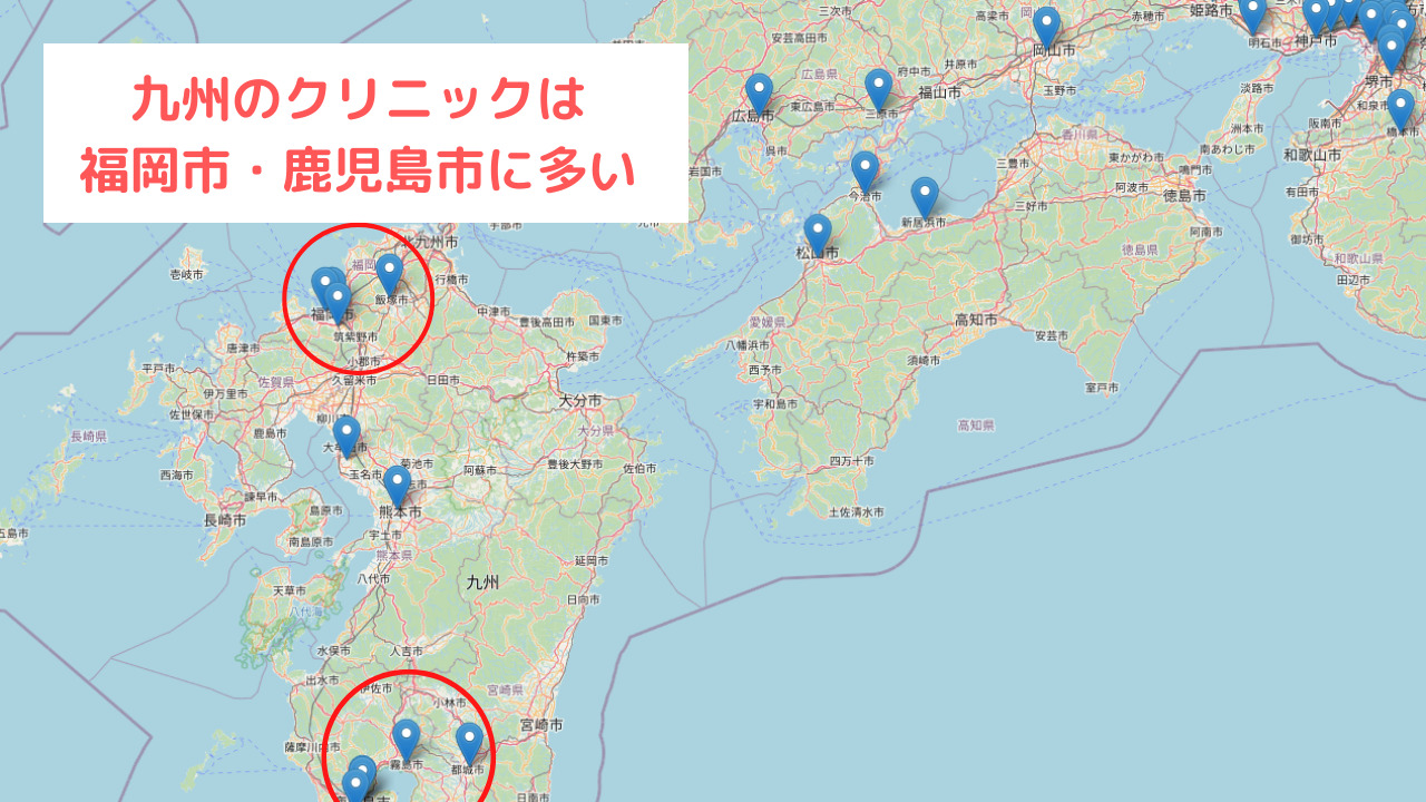 ICLを選ぶならどこ？地域別おすすめクリニック一覧（北海道・関東・中部・関西・九州） | QOLabo