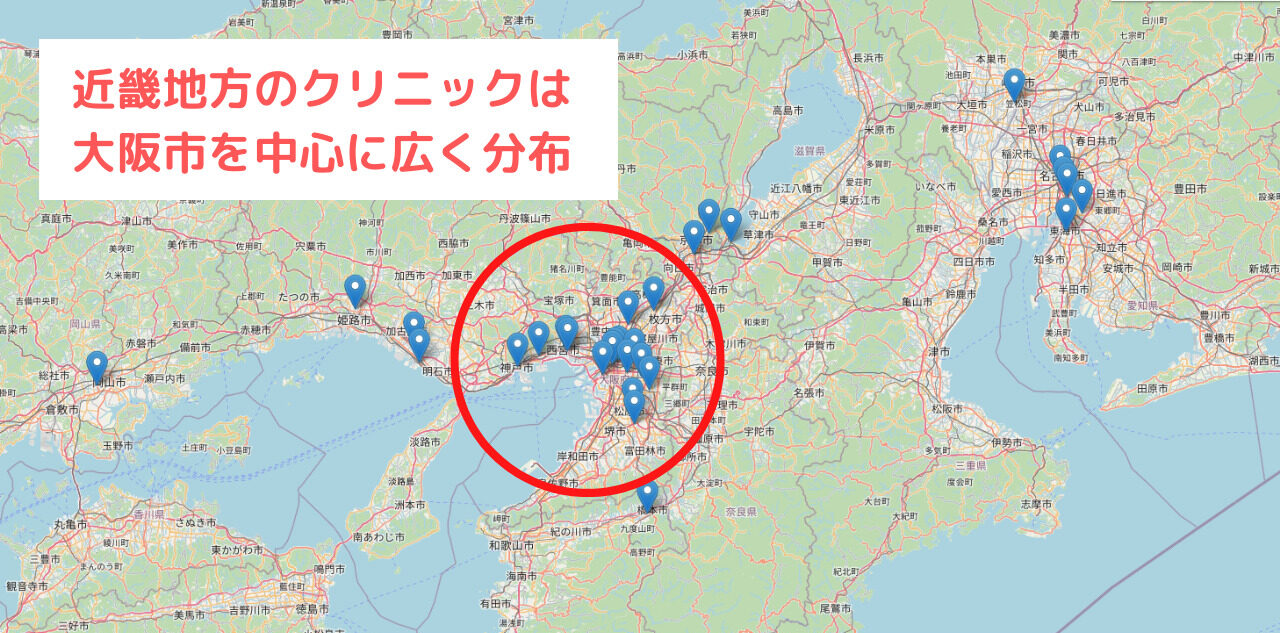 ICLを選ぶならどこ？地域別おすすめクリニック一覧（北海道・関東・中部・関西・九州） | QOLabo