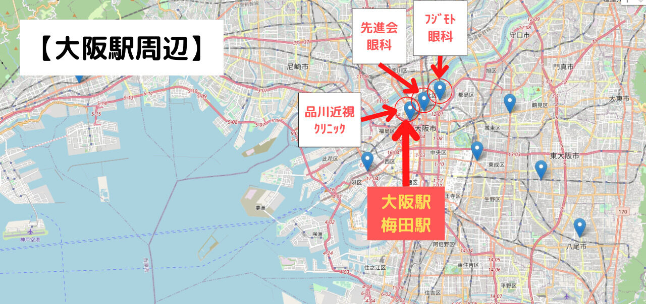 ICLを選ぶならどこ？地域別おすすめクリニック一覧（北海道・関東・中部・関西・九州） | QOLabo